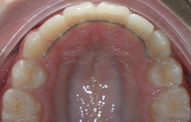 Traitements - Chirurgien Dentiste Cherbourg